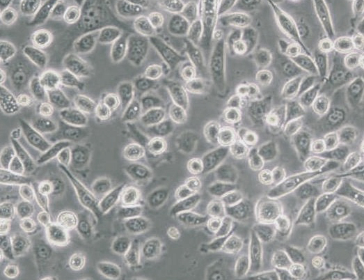 PC9细胞（人肺癌细胞 ）_思泰默细胞