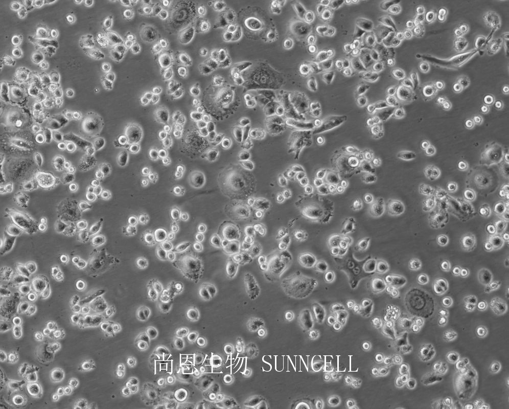 aspc1细胞（人转移胰腺癌细胞系）_思泰默细胞