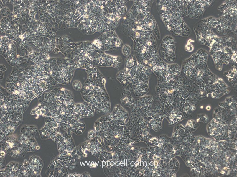 huh1细胞（人肝癌细胞系）_思泰默细胞